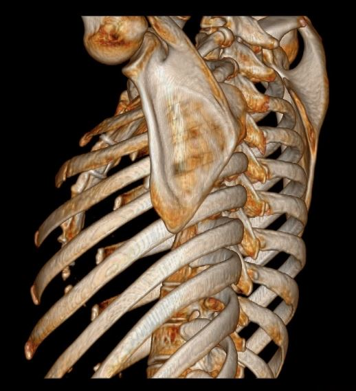 Can You Live a Normal Life with Straight Back Syndrome? – Leaderrush